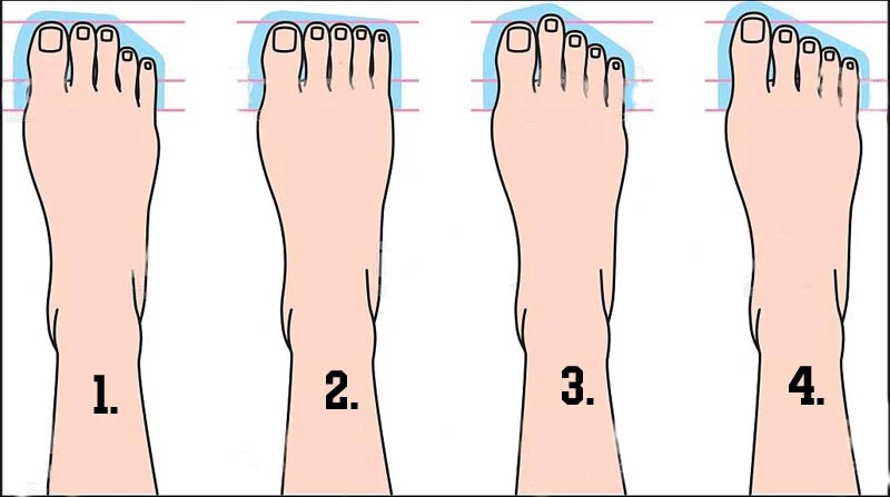 Cách chọn dép phù hợp với từng dáng chân – Feet.vn